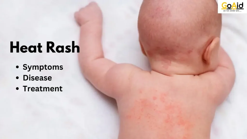 7 Most Common Diseases In Summer Symptoms Causes Treatment Guide