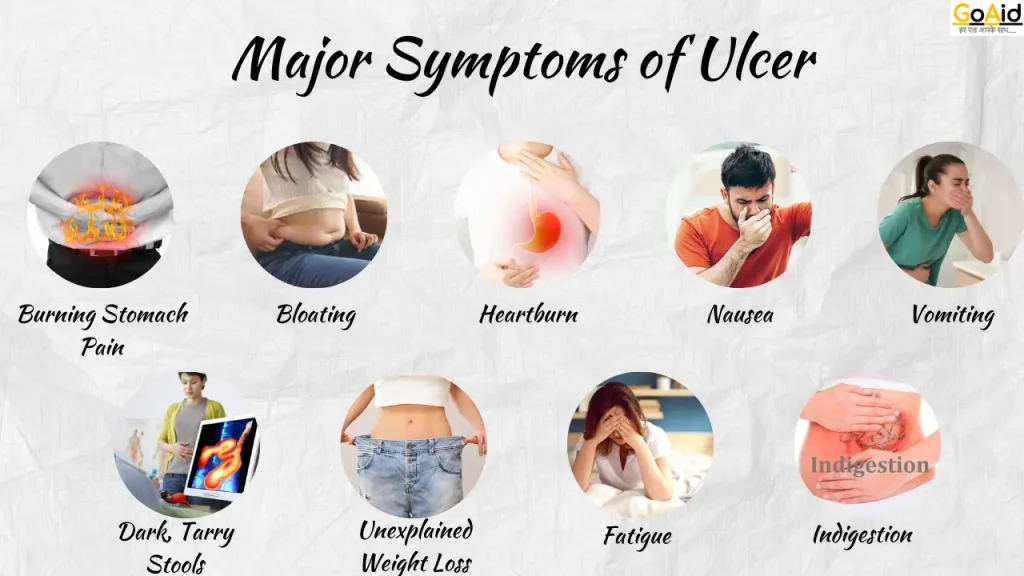 Peptic Ulcers: Causes, Symptoms, and Treatment
